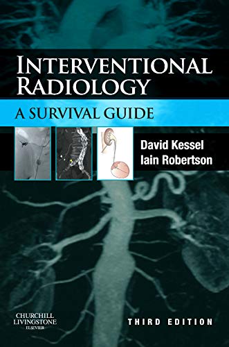 Interventional Radiology: A Survival Guide: 9780702033896: Medicine ...