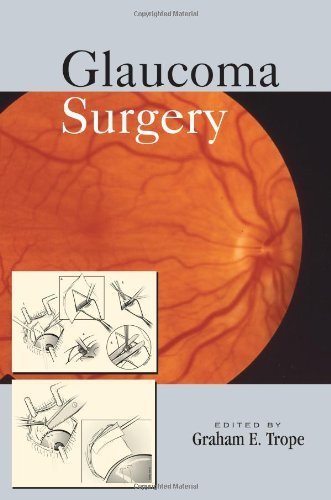 Glaucoma Surgery (Book & DVD): 9780824727437: Medicine & Health Science ...