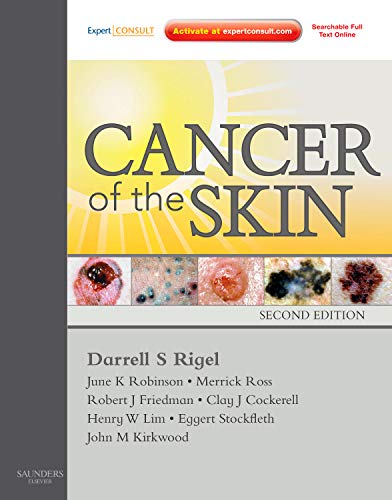 Cancer of the Skin: Expert Consult - Online and Print - Stockfleth Dr ...