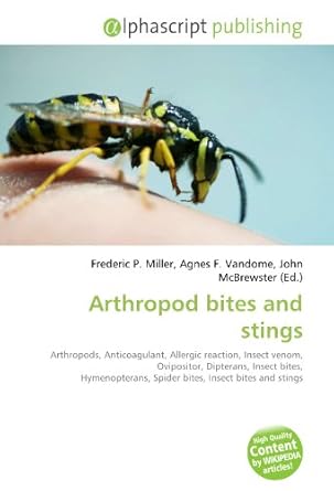 Arthropod bites and stings: Arthropods, Anticoagulant, Allergic ...