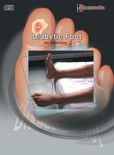 Diabetic Foot : Focus Medica Pte Ltd: Amazon.de: Bücher