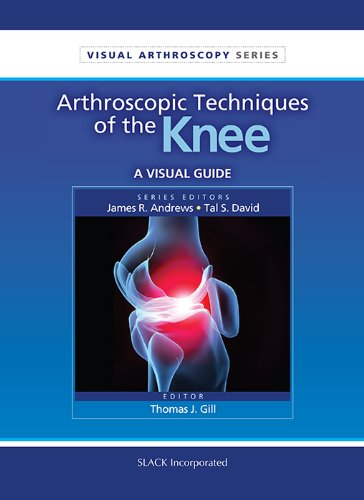 Arthroscopic Techniques of the Knee: A Visual Guide (Visual Arthroscopy ...