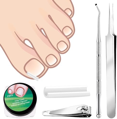 Amazon.com: Titanium Alloy Ingrown Toenail Treatment & Removal Kit for ...