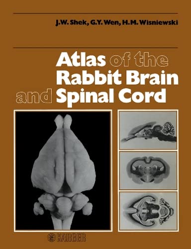 Atlas of the Rabbit Brain and Spinal Cord: 9783805538145: Medicine ...