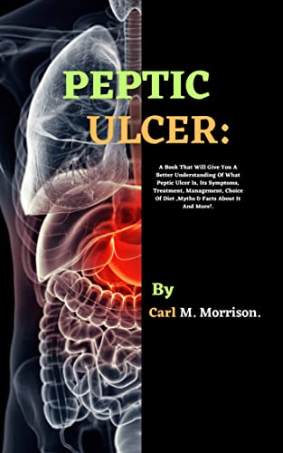 PEPTIC ULCER: A Book That Will Give You A Better Understanding Of What ...