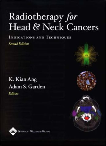 Radiotherapy for Head and Neck Cancer: Indications and Techniques ...