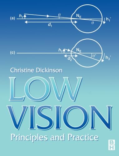 Low Vision: Principles and Practice: 9780750622622: Medicine & Health ...