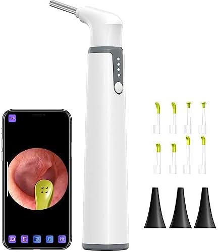 Digital Wifi Otoscope For ENT Ear Inspection Camera With HD Resolution ...