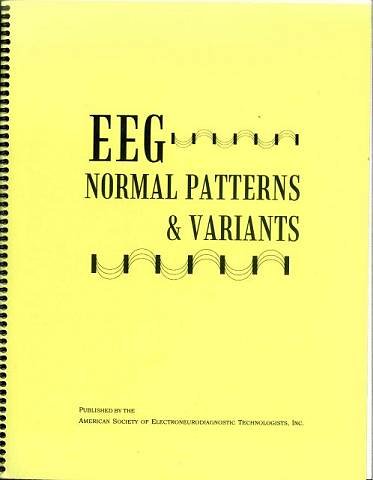 Amazon.fr - EEG Normal Patterns & Variants [Spiral-bound] by ASET - Livres