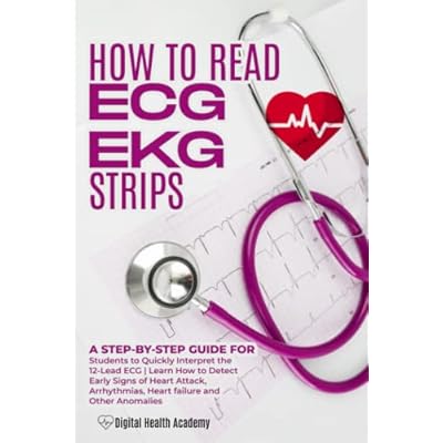 EKGECG Strip Reading Guide: Learn to Interpret Nepal | Ubuy