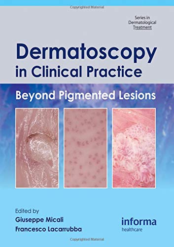 Dermatoscopy in Clinical Practice: Beyond Pigmented Lesions (Series in ...