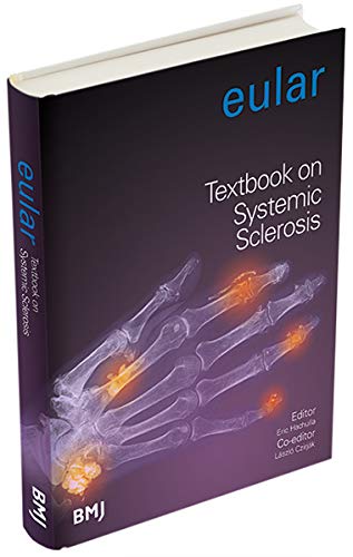 Buy EULAR Textbook on Systemic Sclerosis Book Online at Low Prices in ...