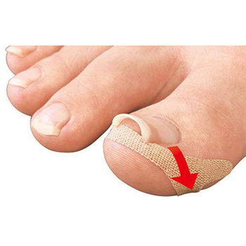 Amazon.com : Zyplus Ingrown Nail Tape Kuikomanu 20 Sheets : Beauty ...