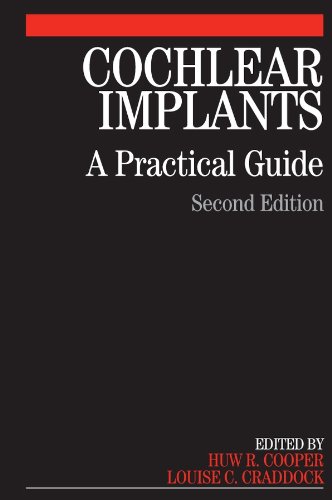 Amazon.com: Cochlear Implants: A Practical Guide eBook : Cooper, Huw ...