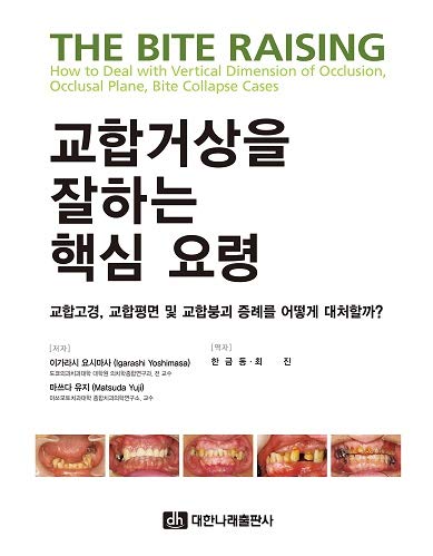 교합거상을 잘하는 핵심 요령 The Bite Raising How to Deal with Vertical Dimension of ...