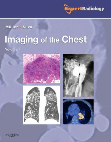Imaging of the Chest, 2-Volume Set: Expert Radiology Series ...