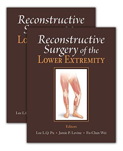 Reconstructive Surgery of the Lower Extremity (Two-Volume Set ...