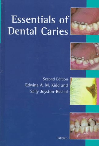 Essentials of Dental Caries: 9780192626929: Medicine & Health Science ...