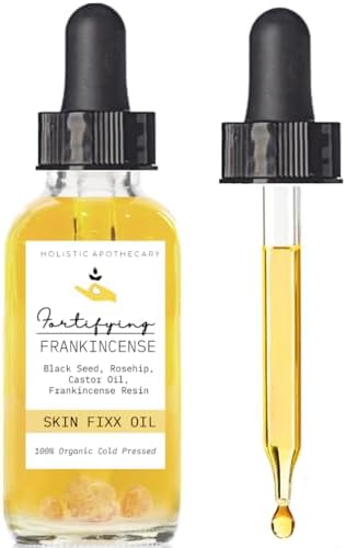 Amazon.com: Rosehip Oil Black Seed Oil and Castor Oil Face Serum, Castor Oil Black Seed Oil ...