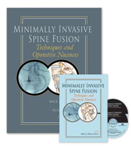 Minimally Invasive Spine Fusion: Techniques and Operative Nuances Book ...