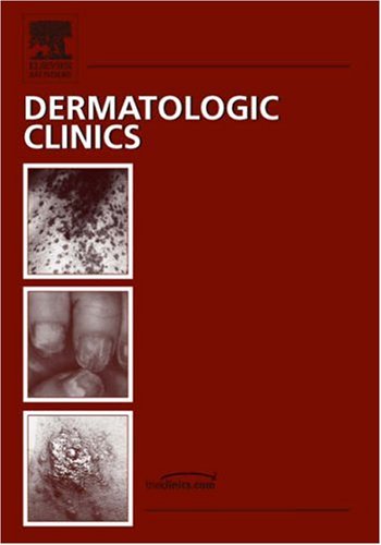 Update on HIV/AIDS, An Issue of Dermatologic Clinics (Volume 24-4) (The ...
