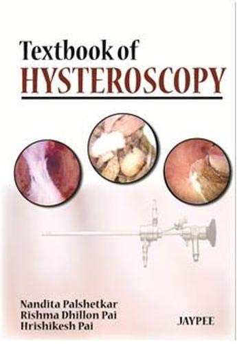 Textbook of Hysteroscopy: 9789350257814: Medicine & Health Science ...