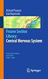 【発売日：2010年11月12日】・製造元:Springer