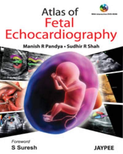 Buy Atlas of Fetal Echocardiography with Interactive DVD-ROM Book Online at Low Prices in India ...