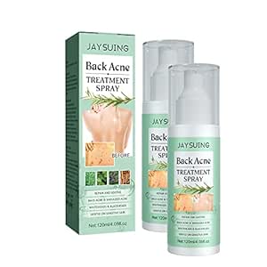 Amazon.com : Back Acne Treatment Spray, Herbaluxy Back Acne Spray, 2% ...