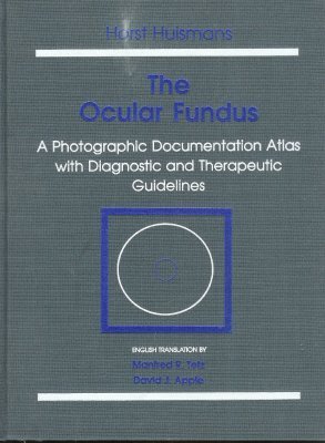 The Ocular Fundus: A Photographic Documentation Atlas With Diagnostic ...