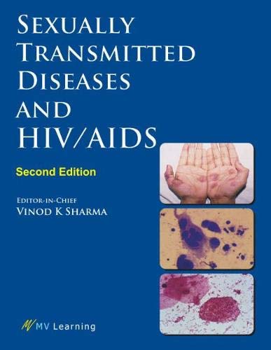 Buy Sexually Transmitted Diseases and HIV/AIDS Book Online at Low ...