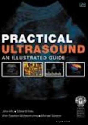 (OLD)PRACTICAL ULTRASOUND AN ILLUSTRATED GUIDE : Jane Alty: Amazon.in ...