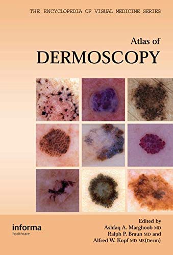 An Atlas of Dermoscopy (Encyclopedia of Visual Medicine Series ...