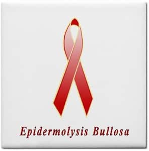 Amazon.com: Epidermolysis Bullosa Awareness Ribbon Tile Trivet: Home ...