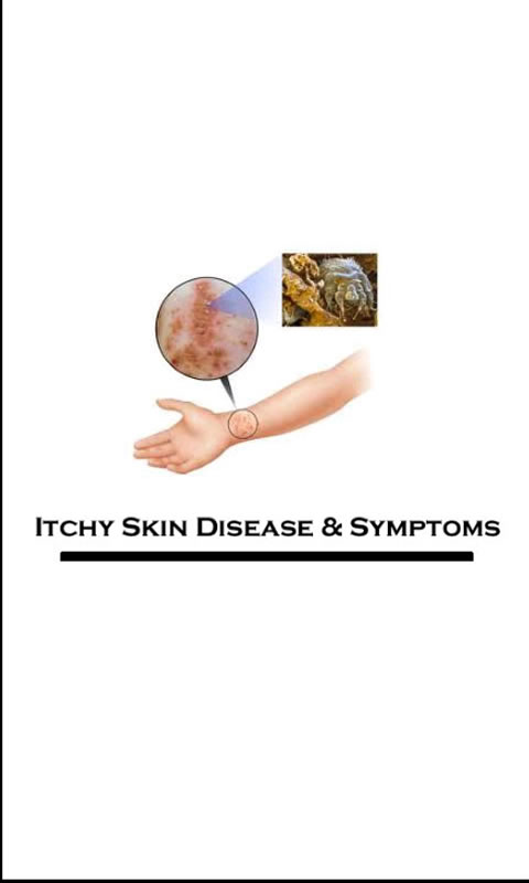 Itchy Skin Disease & Symptoms:Amazon.ca:Appstore for Android