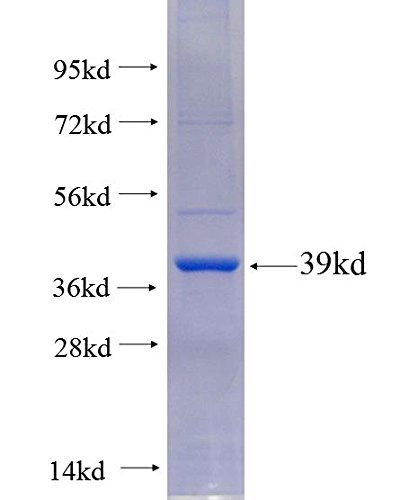 Amazon.com: Human PAM Fusion Protein : Industrial & Scientific