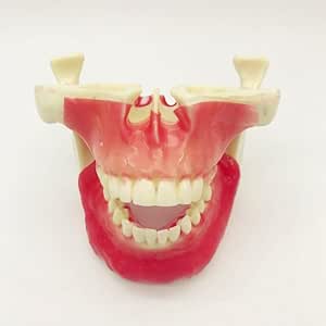 Amazon.com: Teeth Study Teaching Model Maxillary Implant Model, Dental ...
