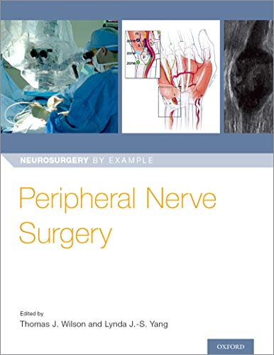 Peripheral Nerve Surgery (Neurosurgery by Example) eBook : Wilson ...