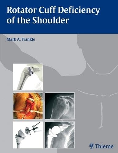 Rotator Cuff Deficiency of the Shoulder : Frankle, Mark: Amazon.de: Bücher