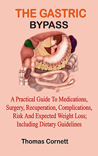 THE GASTRIC BYPASS: A Practical Guide to Medications, Surgery ...