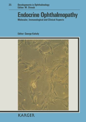 Endocrine Ophthalmopathy: Molecular, Immunological and Clinical Aspects ...