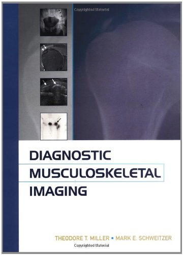 Buy Diagnostic Musculoskeletal Radiology Book Online at Low Prices in ...