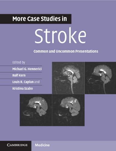 More Case Studies in Stroke: Common and Uncommon Presentations (Case ...