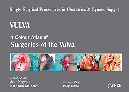 Single Surgical Procedures in Obstetrics and Gynaecology-01: Vulva-A ...