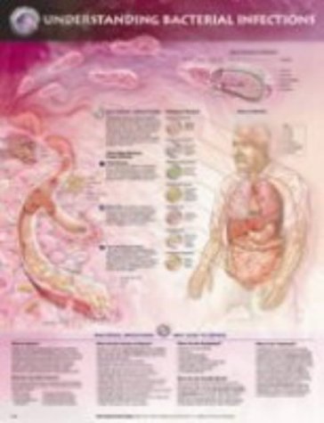 Understanding Bacterial Infections Chart : Amazon.sg: Books