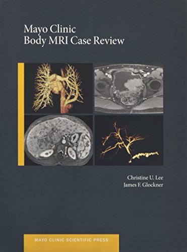 Mayo Clinic Body MRI Case Review (Mayo Clinic Scientific Press ...
