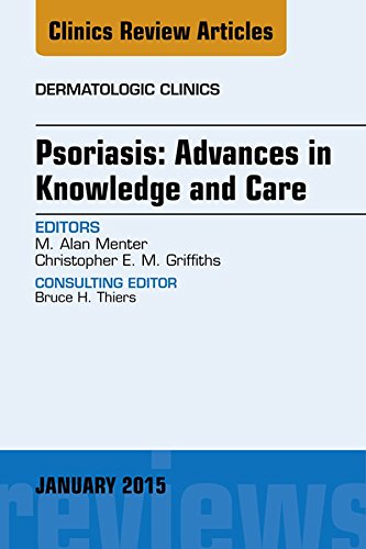 Amazon.com: Psoriasis: Advances in Knowledge and Care, An Issue of ...