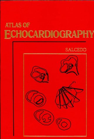 Atlas of Echocardiography: 9780721678993: Medicine & Health Science ...