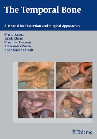 The Temporal Bone: A Manual for Dissection and Surgical Approaches ...