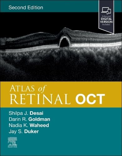 Atlas of Retinal OCT: Optical Coherence Tomography: 9780323930437 ...